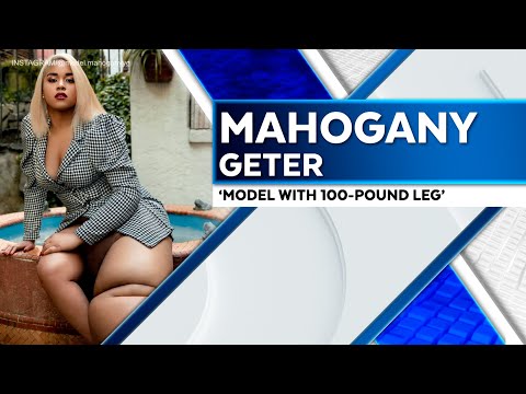 'Confidence ... Came Through Modeling:' Woman With 100-Pound Leg Used to Hide. Now She Models.