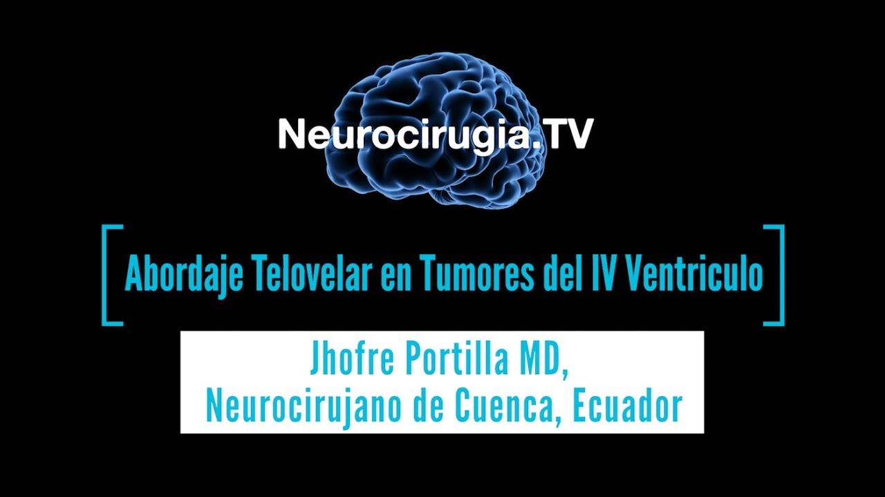 Abordaje Telovelar en Tumores del IV Ventriculo Jhofre Portilla - YouTube