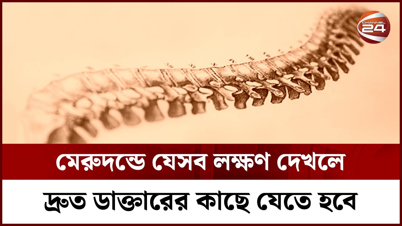 মেরুদন্ডে যেসব লক্ষণ দেখলে দ্রুত ডাক্তারের কাছে যেতে হবে || Backbone ...