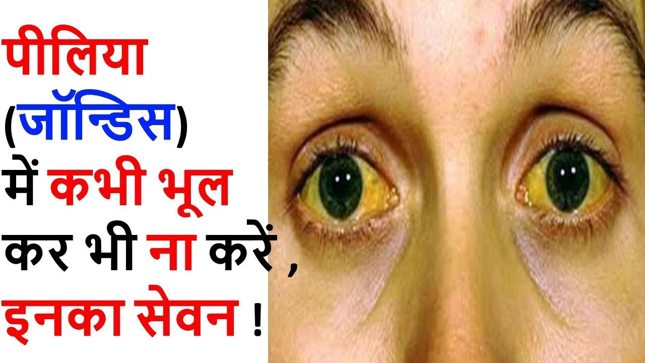 पीलिया(जोन्डिश) में कभी ना इनका प्रयोग करे ! Never use them in jaundice ...