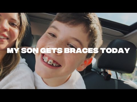 My son gets braces for the first time! - YouTube