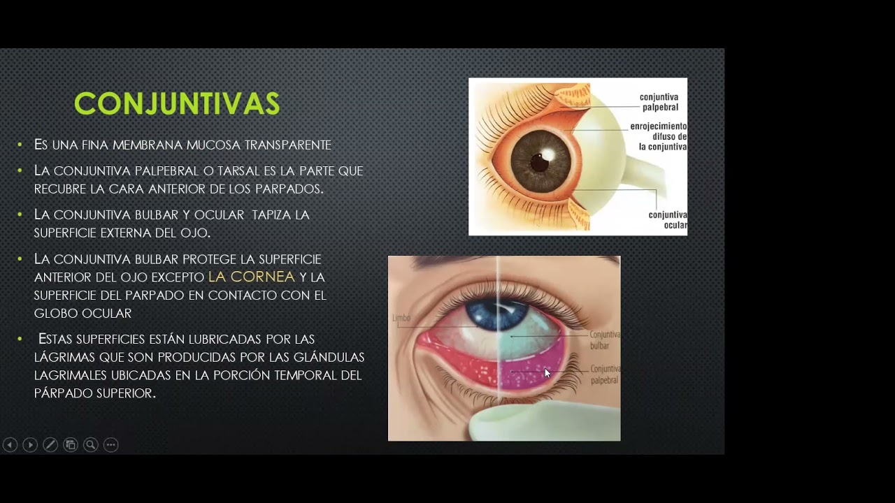 EXAMEN FISICO DE OJO II 2022 - YouTube