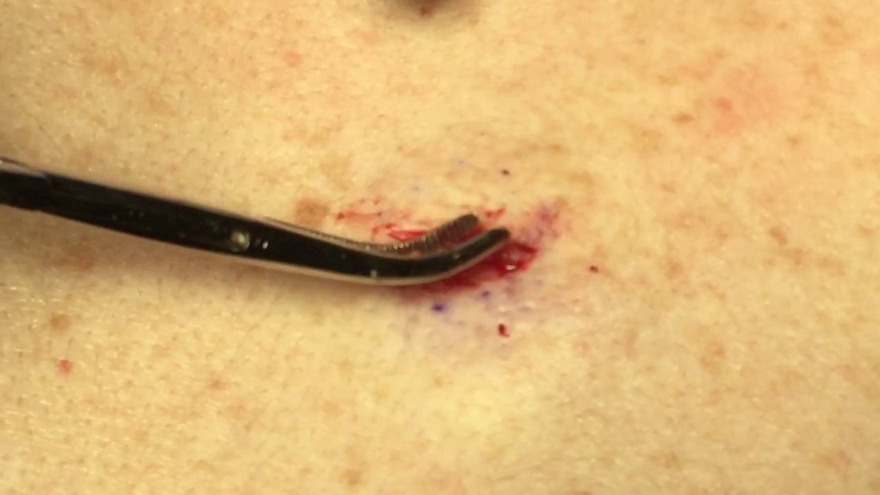 Simple bump - YouTube