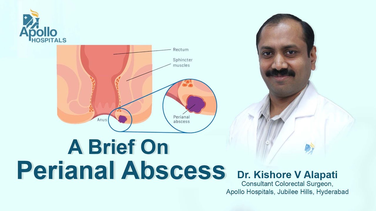 Perineal Abscess Male