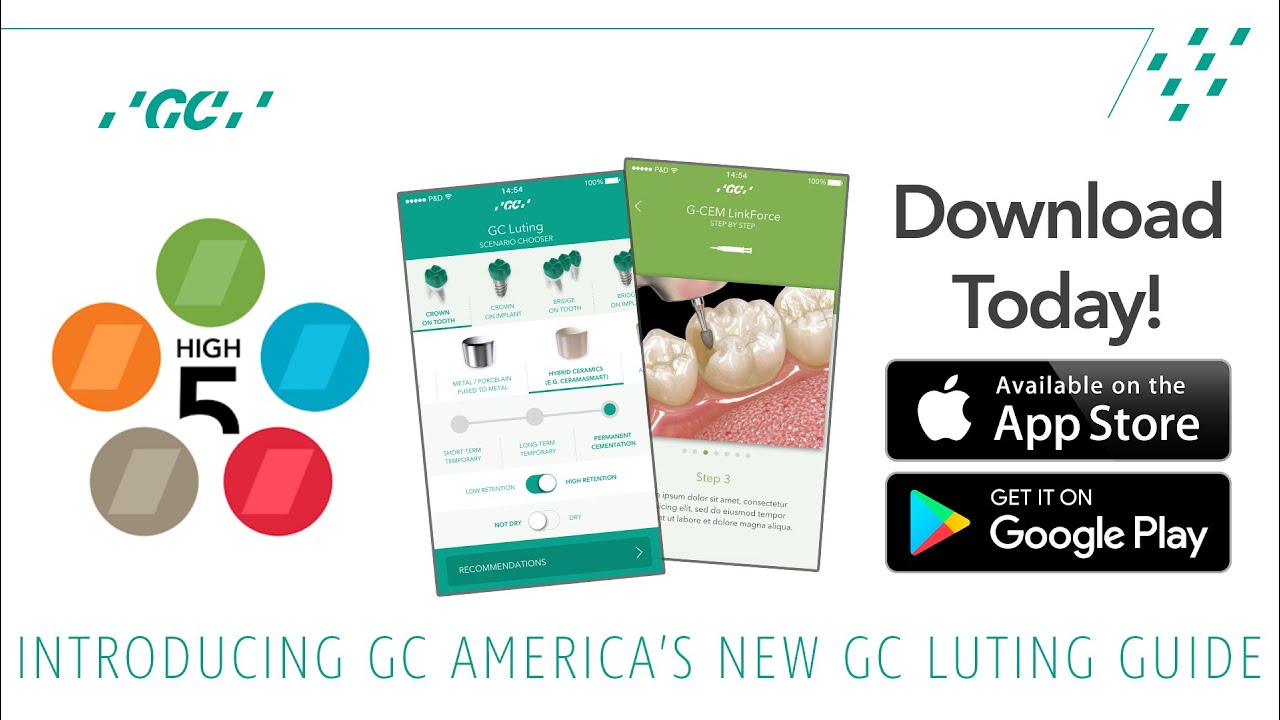 The All New GC Luting Guide - YouTube