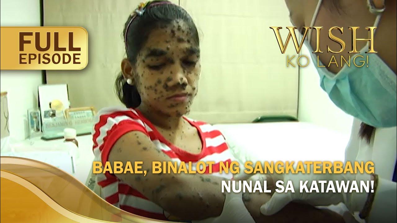 Babae, binalot ng sangkaterbang nunal sa katawan! (Full Episode) | Wish Ko Lang - YouTube