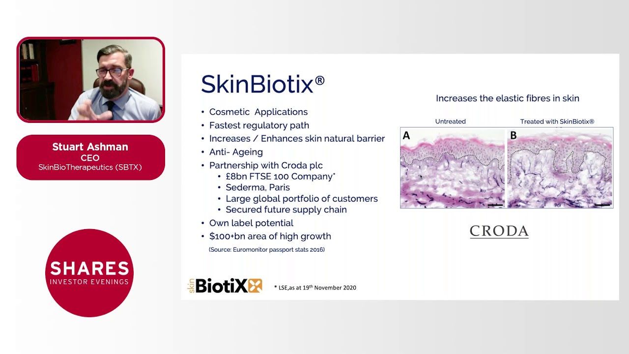 SkinBioTherapeutics (SBTX) - Stuart Ashman, CEO - YouTube