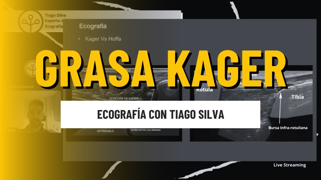 Grasa Kager y ecografia con Tiago Silva - YouTube
