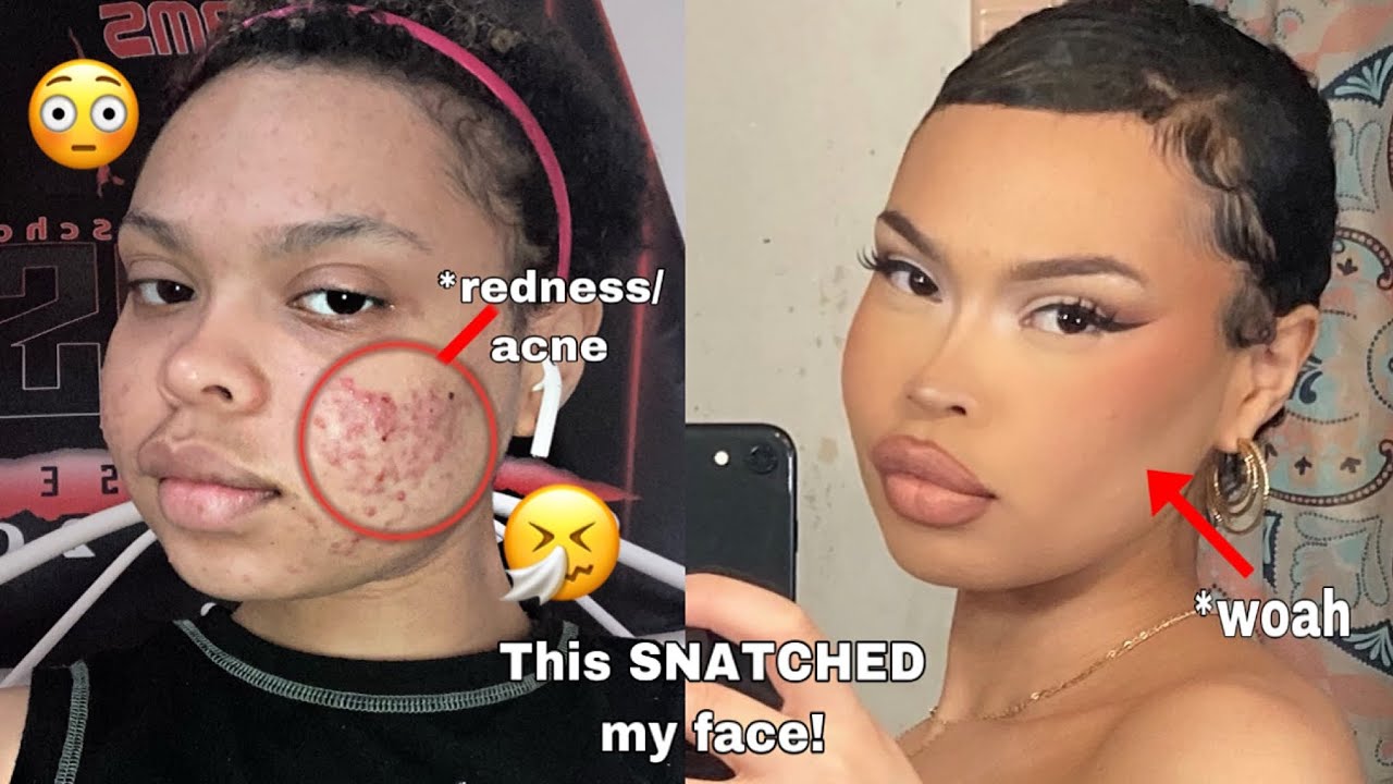 Trying the “clean girl” makeup w/ acne! - YouTube