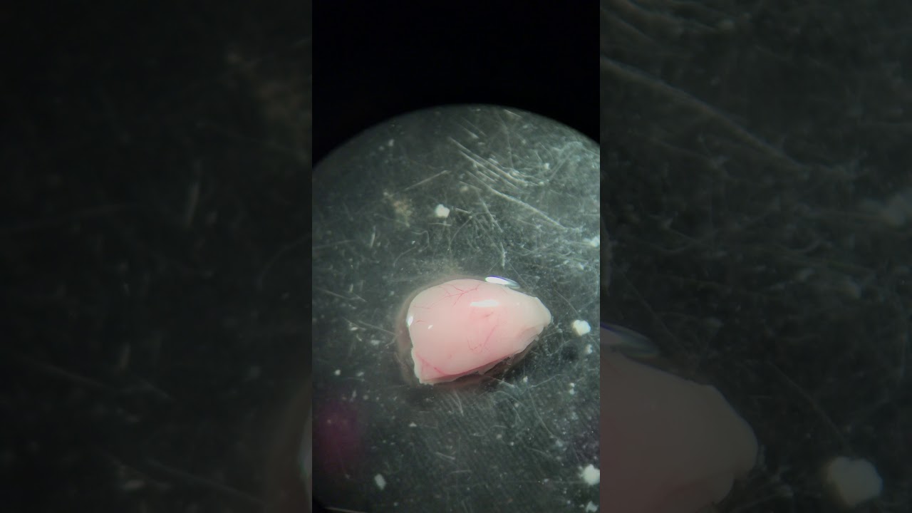 Dissection of mouse choroid plexus - YouTube