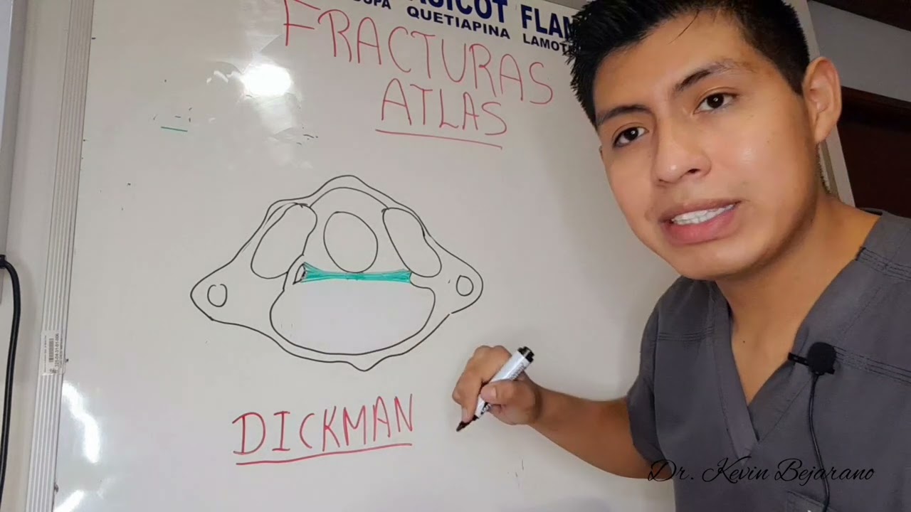 FRACTURAS DEL ATLAS. generalidades, clasificación de LANDELL y de ...