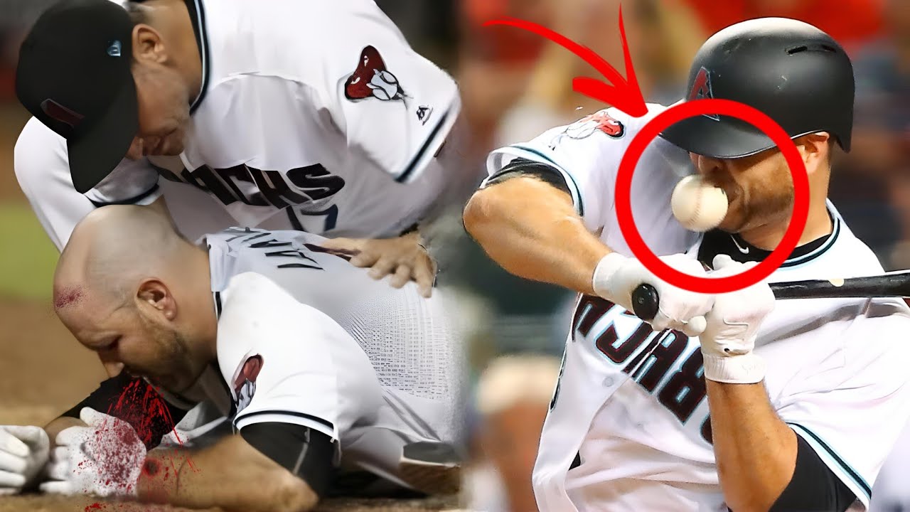MLB// Worst Hit By Pitch• Part1 - YouTube