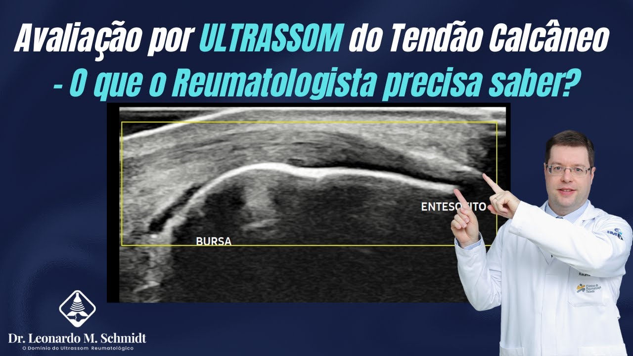 Ultrassom do Tendão Calcâneo - O que o Reumatologista deve saber? - YouTube