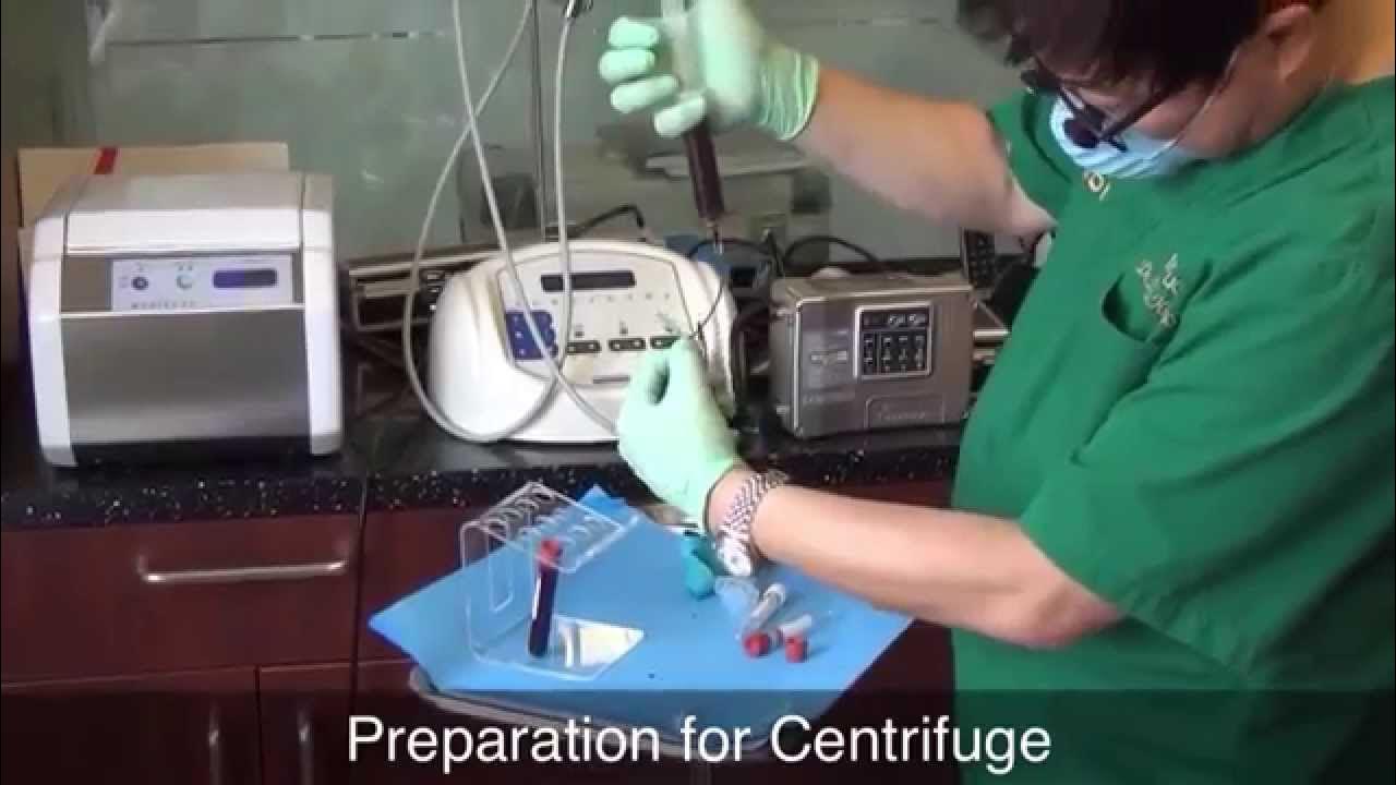 Creating CGF Membrane and AFG for Putty Bone - YouTube