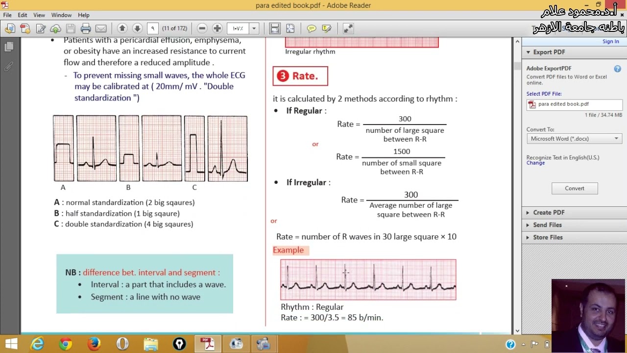 06 6 SYSTEMATIC INTERPRETATION GUIDELINES OF ECG Standardization Rate ...