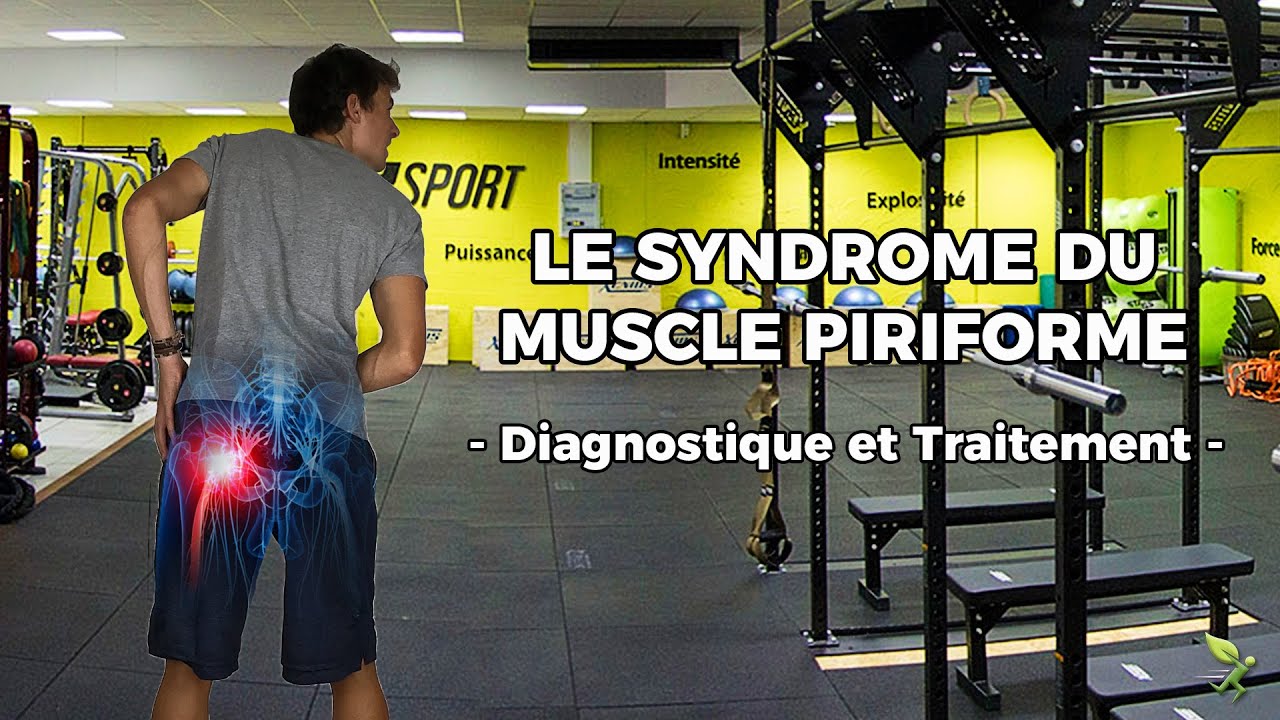 LE SYNDROME DU MUSCLE PIRIFORME (Diagnostic et Traitement) - YouTube