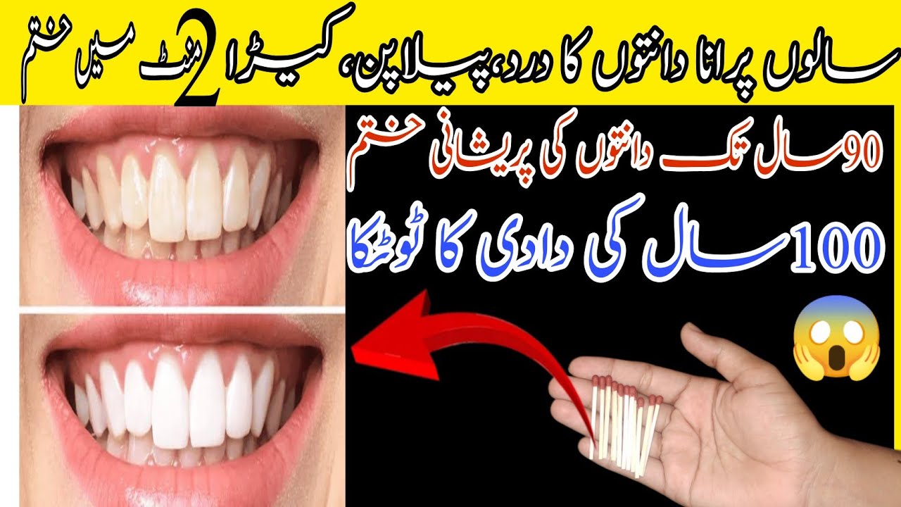 How to Clean Yellow Teeth😬||Peely Danto ki Safai Kesy Karyn😱||Yellow ...