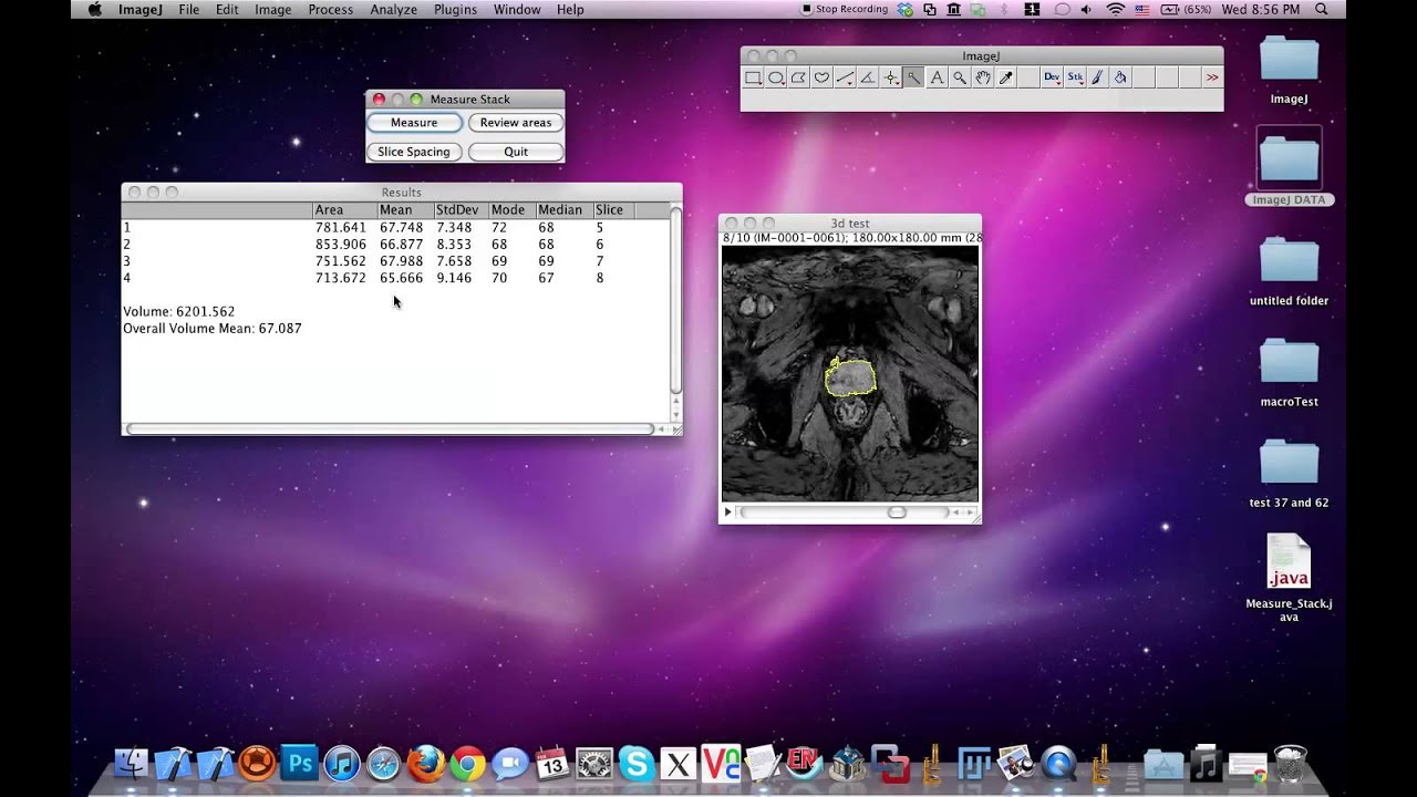 BII ImageJ 익히기 - 07.Volume measurement - YouTube