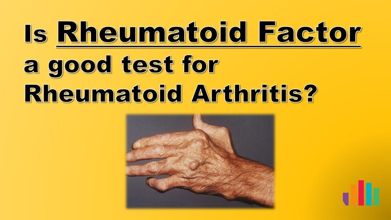 Is Rheumatoid Factor a Good Test for Rheumatoid Arthritis? - YouTube
