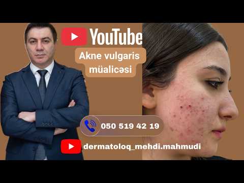 Sızanaqdan necə qurtulmaq olar ?  . Əlaqə- (+994) 50 519 42 19 .