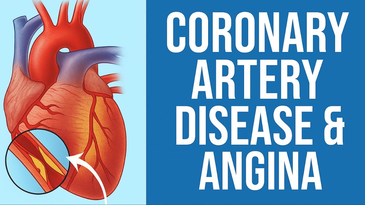 Understanding CAD & Angina | Patient Education Med-Surg - YouTube