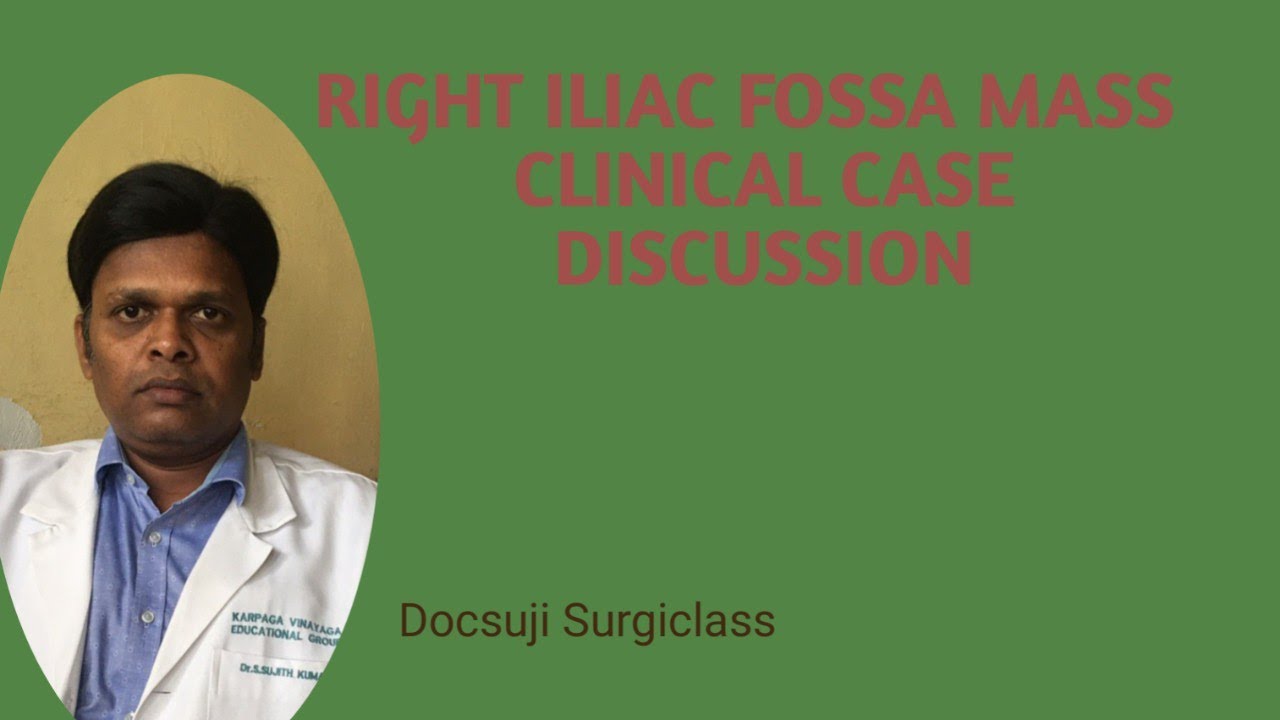 RIF MASS - CLINICAL CASE DISCUSSION - YouTube