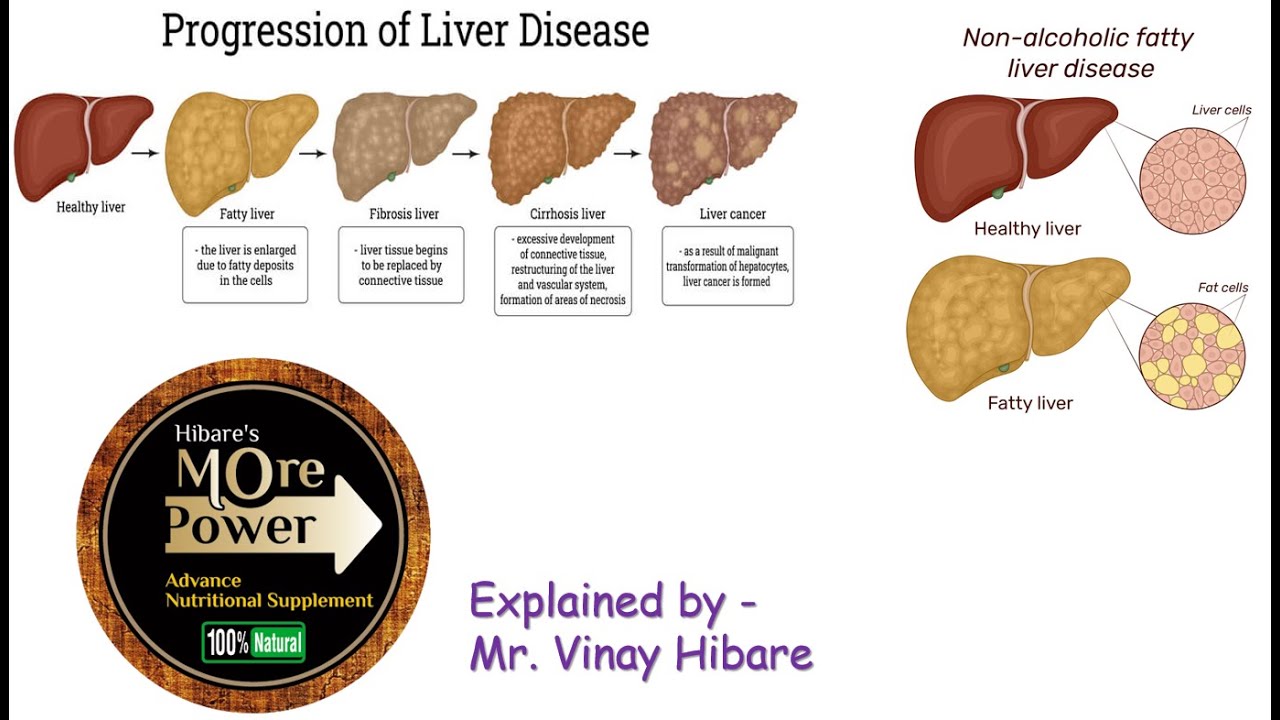 Hibare's More Power Benefits on Liver Health Explained by Scientist ...