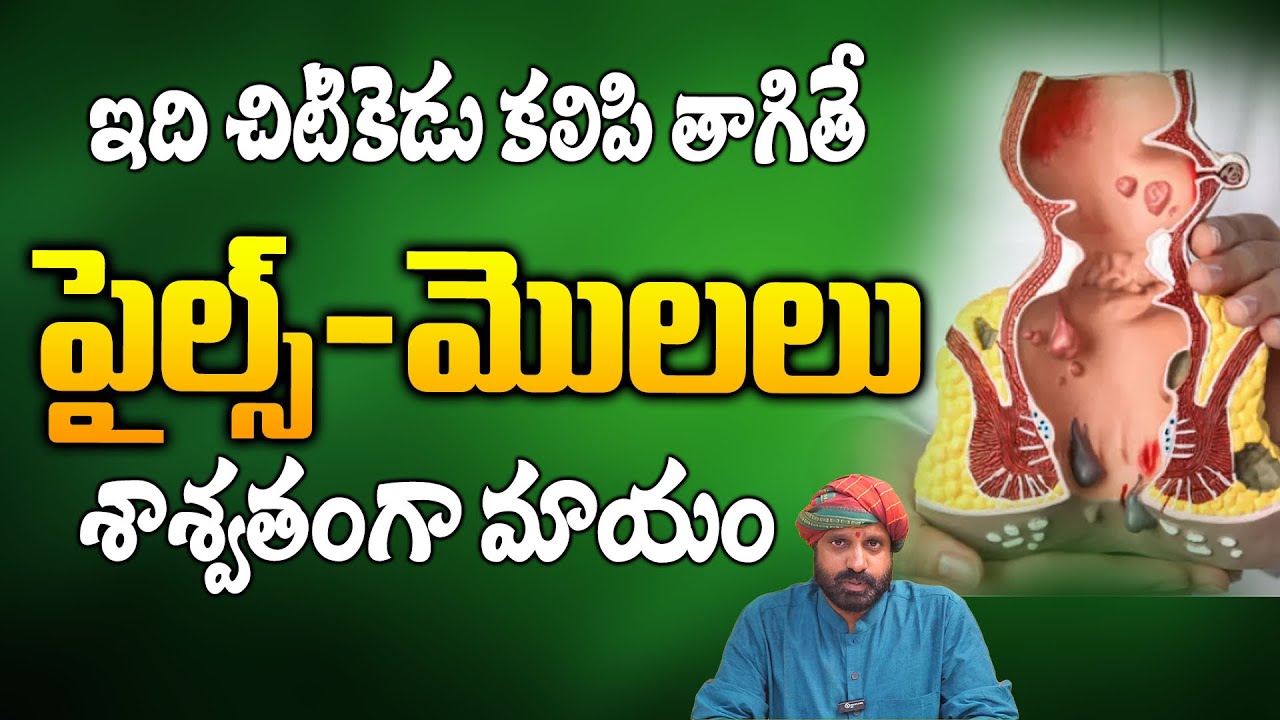 How to Get Relief from Piles Without Operation | Best Tips to Get Rid ...
