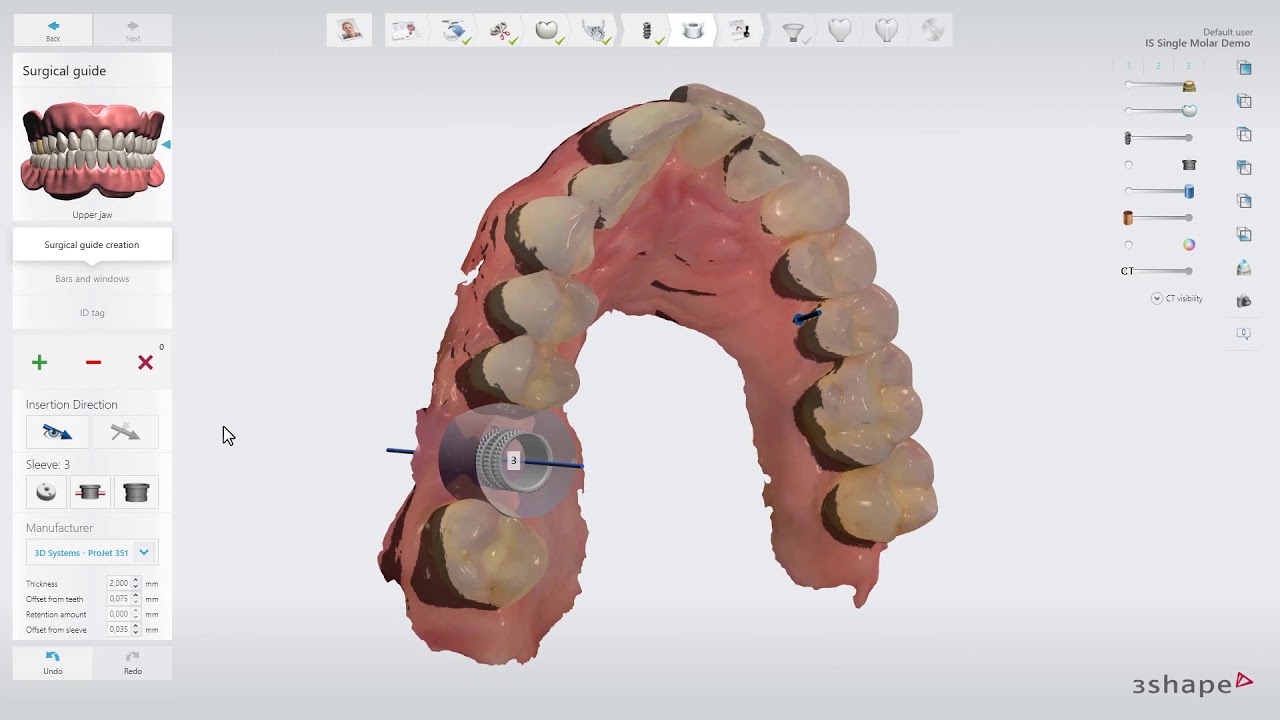 3Shape Implant Studio 2019 - A demo PL - YouTube