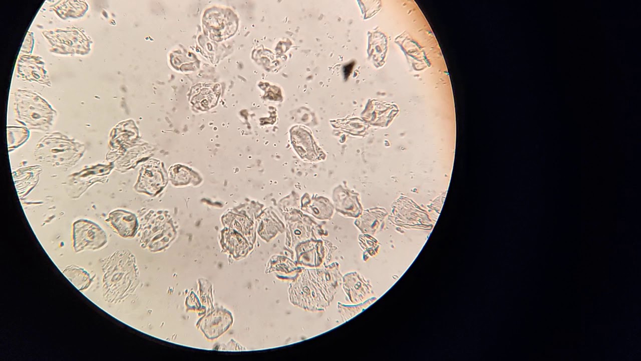 Amorphous, Bacteria and Epithelial cells under microscope - YouTube