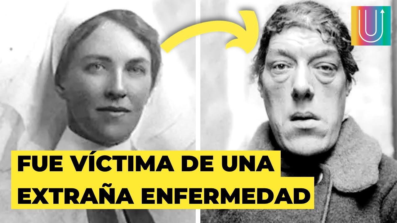 La hermosa historia de la mujer más fea del mundo - YouTube