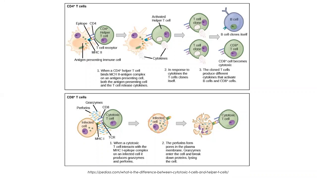 Pathogenesis, Clinical Features, Labs, & Imaging - YouTube