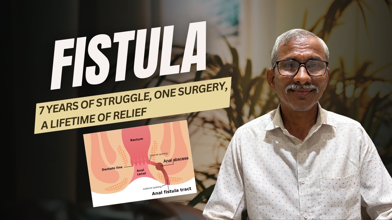 Uddhav's Fistula Recovery Journey | DLPL Surgery at Healing Hands ...