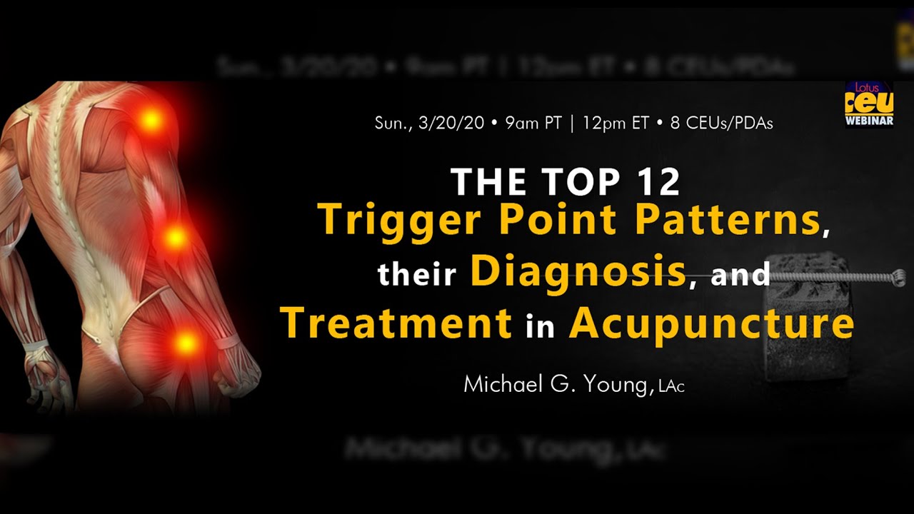 The Top 12 Trigger Point Patterns, Their Diagnosis, and Treatment in ...