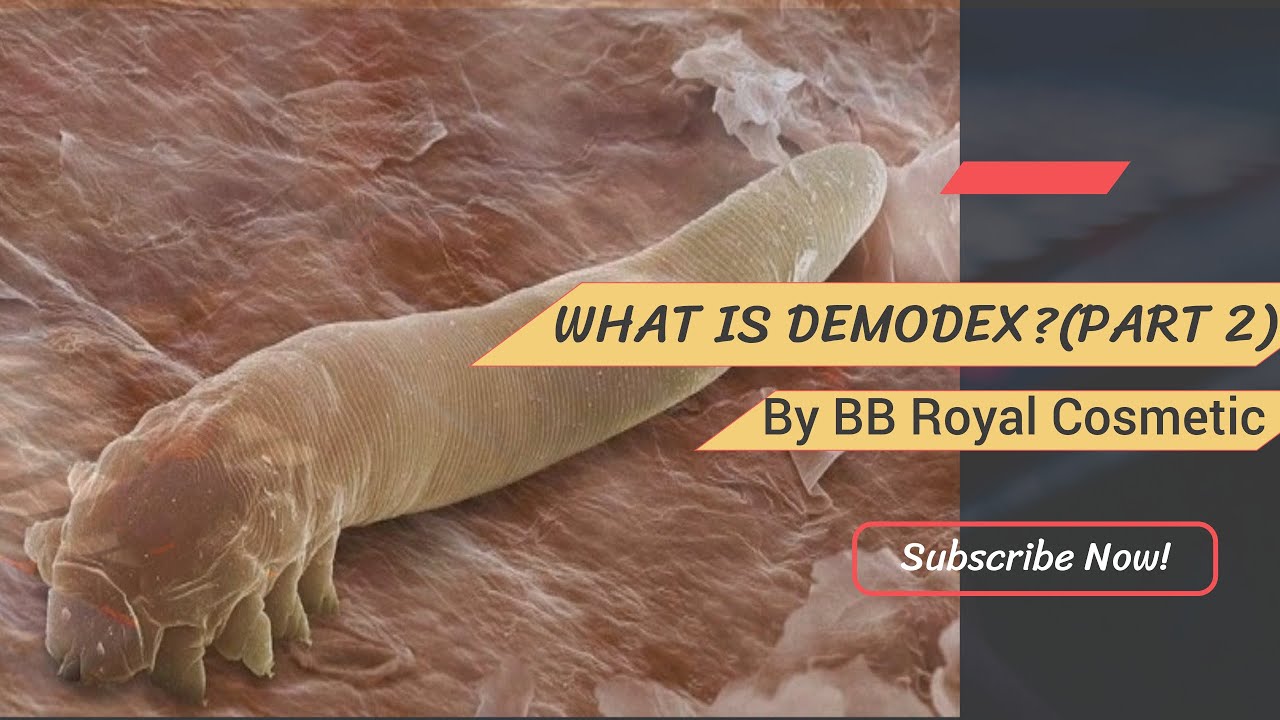 What is Demodex? Should I take a Demodex Test? (Part 2) دمودکس چیست و ...