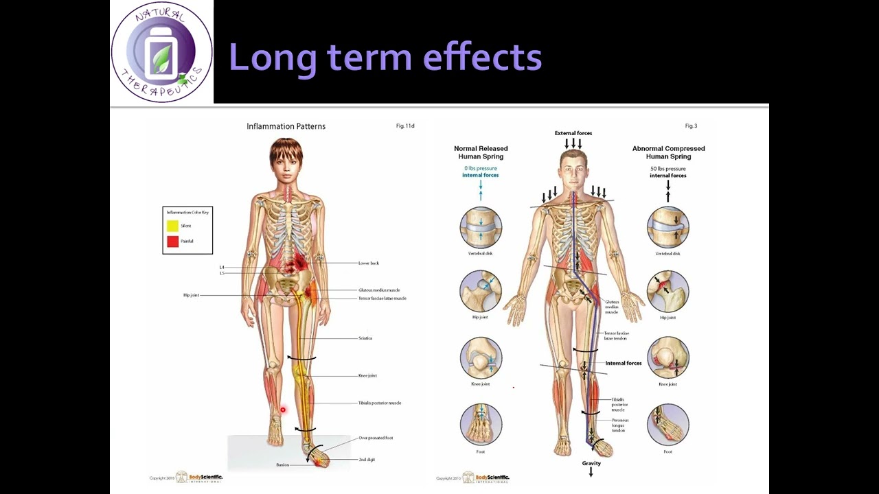 Introduction to Neuroskeletal Re-alignment Therapy - YouTube