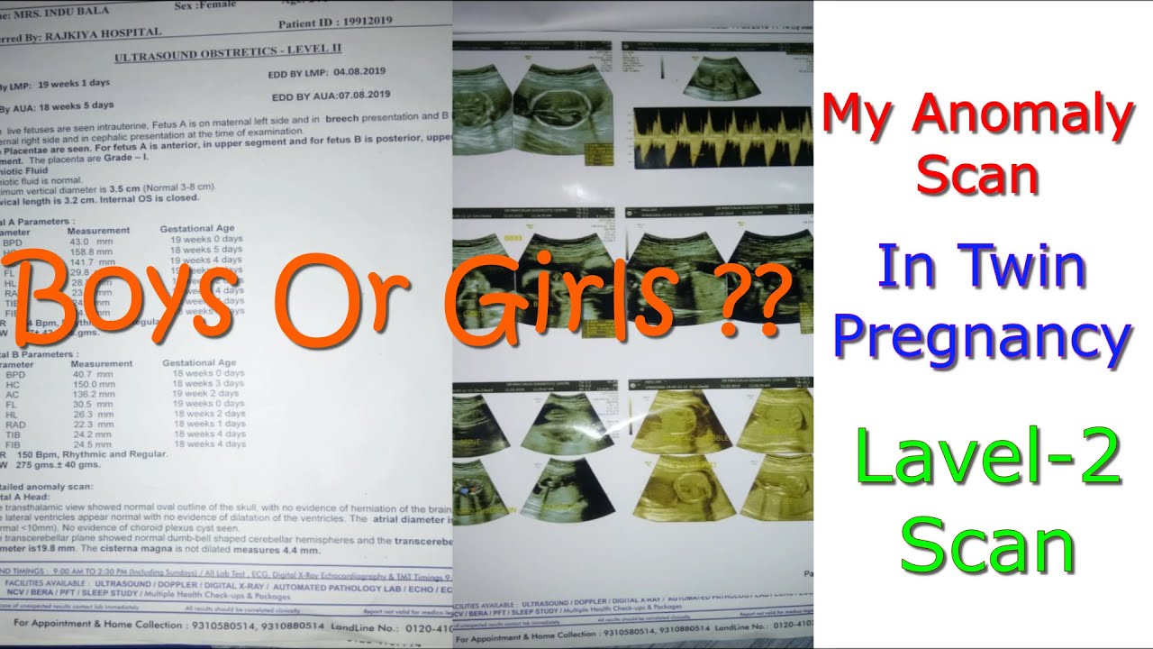 My Anomaly/Level-2 Scan in Twin Pregnancy !! Boys or Girls ?? - YouTube