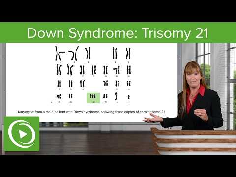 Down Syndrome: Trisomy 21 – Medical Genetics | Lecturio