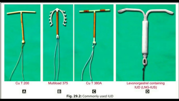 Iud Copper Multiload