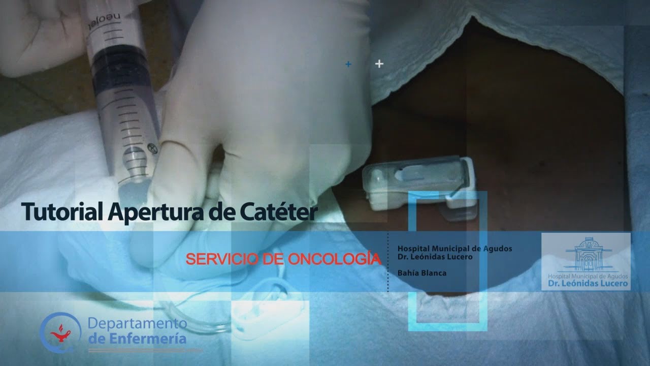 Tutorial de apertura de catéter (Técnica de punción del catéter venoso ...