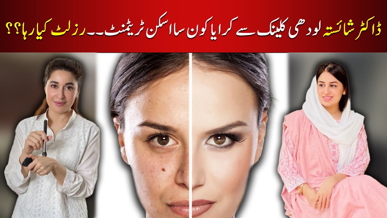 Got My Skin Treatment from Dr. Shaista Lodhi's Aesthetic Clinic | What ...