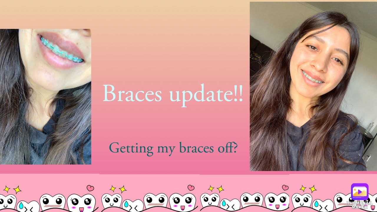 Braces update!! Finally getting my braces off! - YouTube