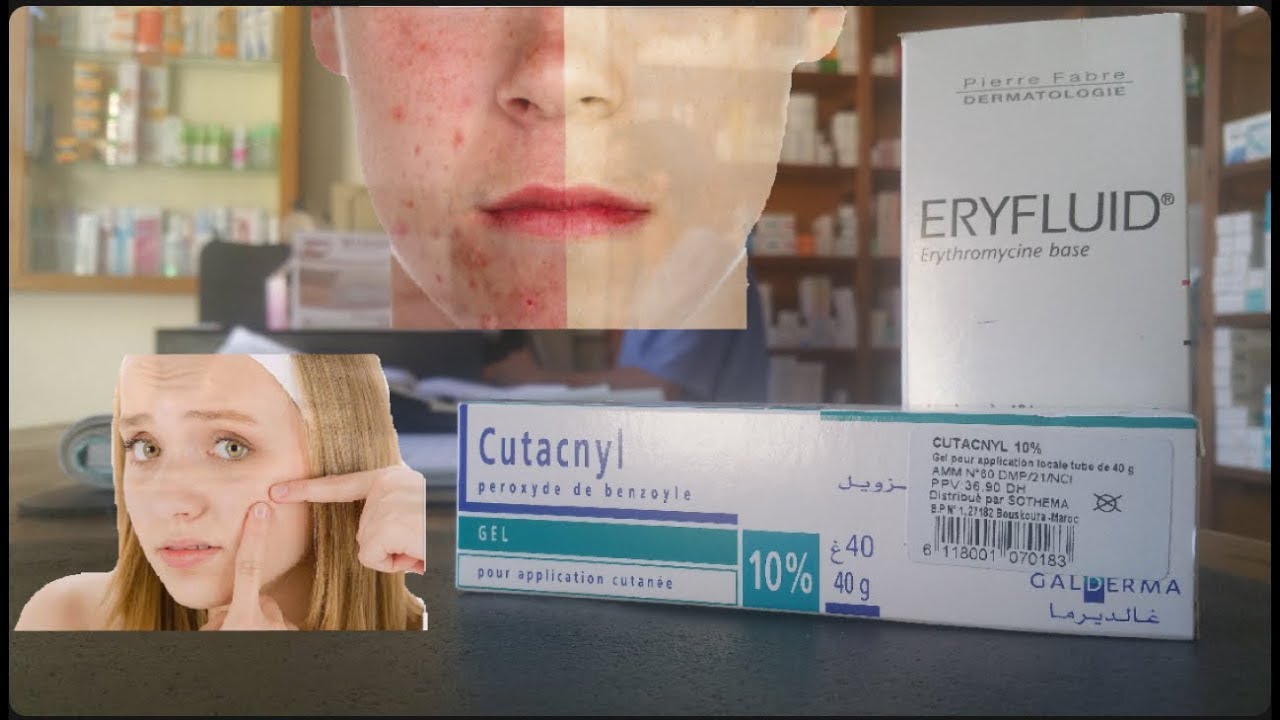 أسهل طريقة لعلاج حب شباب وإزالة البقع بمدة قصيرة cutacnyl Créme - YouTube