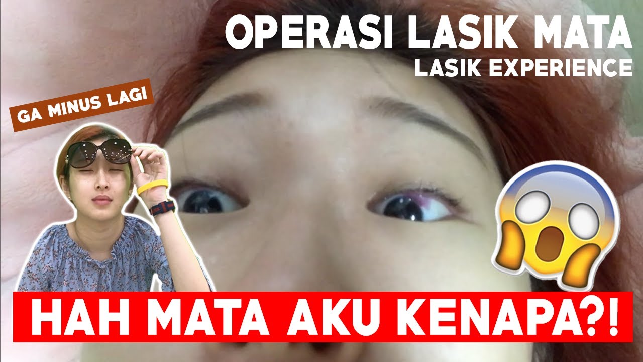 PENGALAMAN OPERASI LASIK MATA!!! (MY LASIK EXPERIENCE) | Korea vlog ...