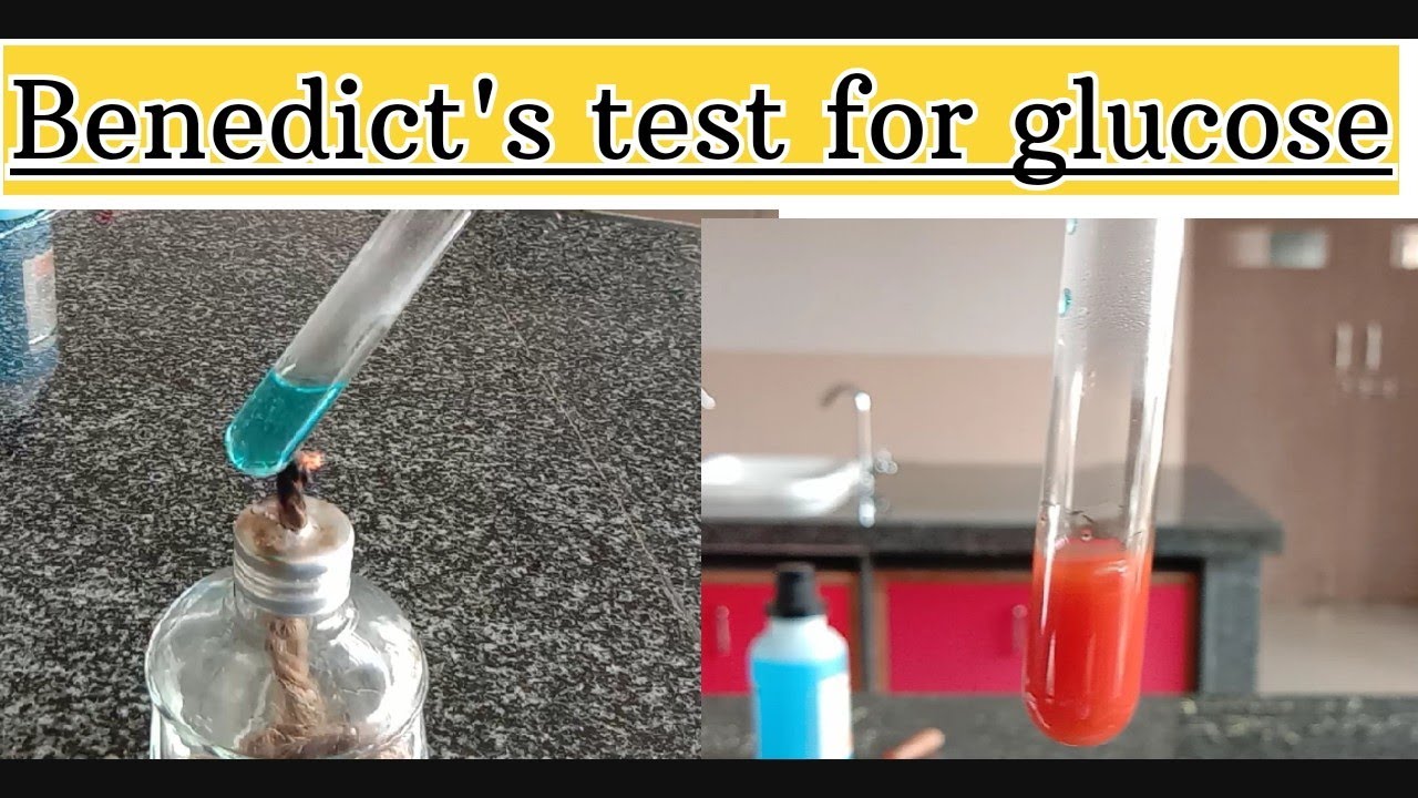 Benedict's Test | PUC FIRST Practical @DNKANNADA - YouTube