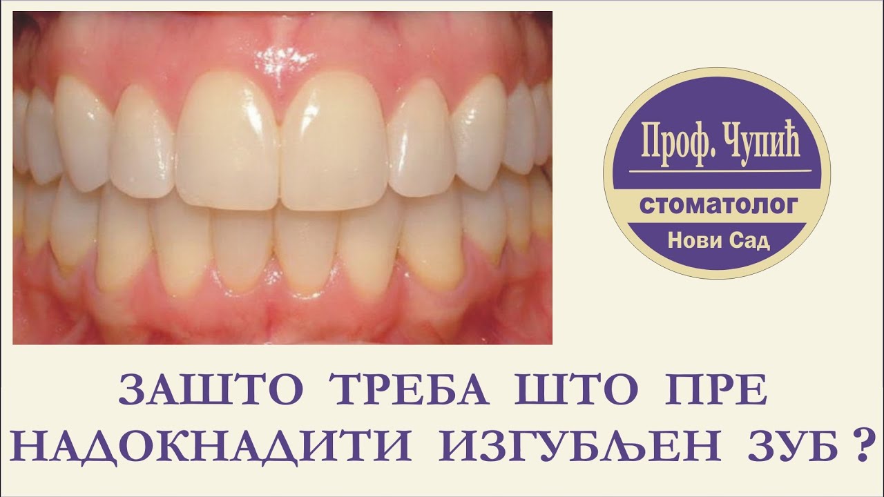 Veštački zubi ( krunice i mostovi ) - YouTube