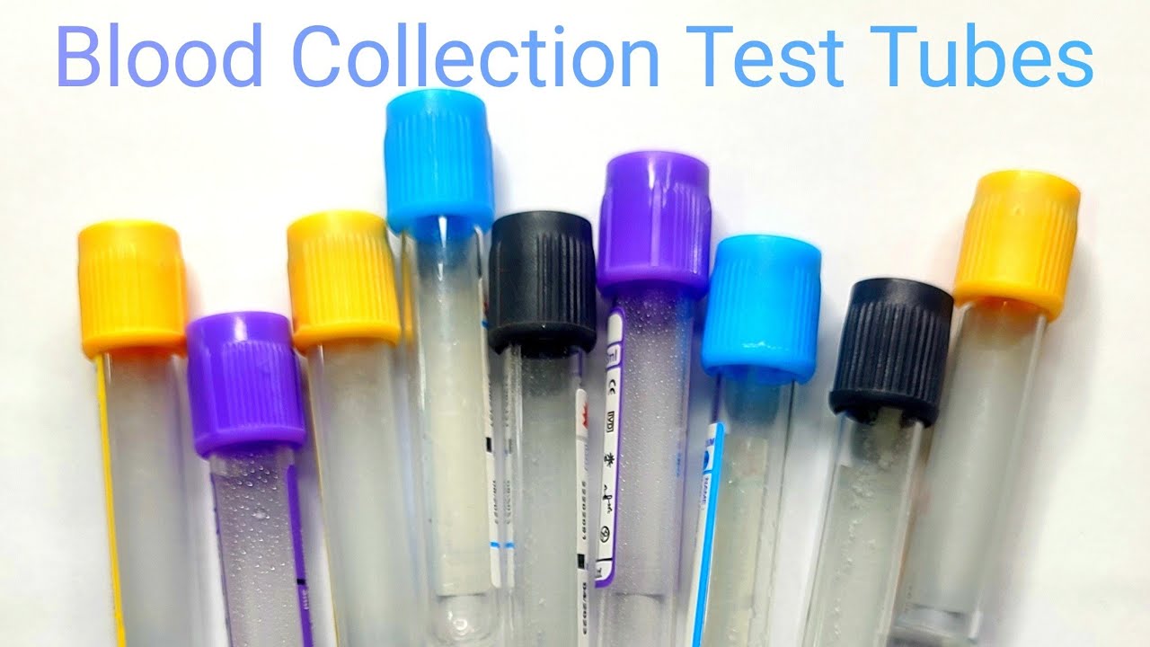 About the Blood collection Colour code Test tube using in the ...