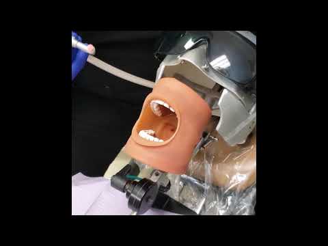 Selective Coronal Polishing - YouTube