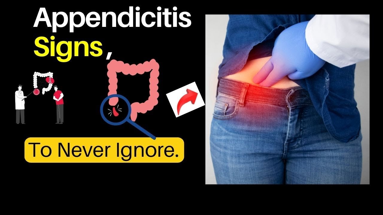 What are top signs of Appendicitis - YouTube