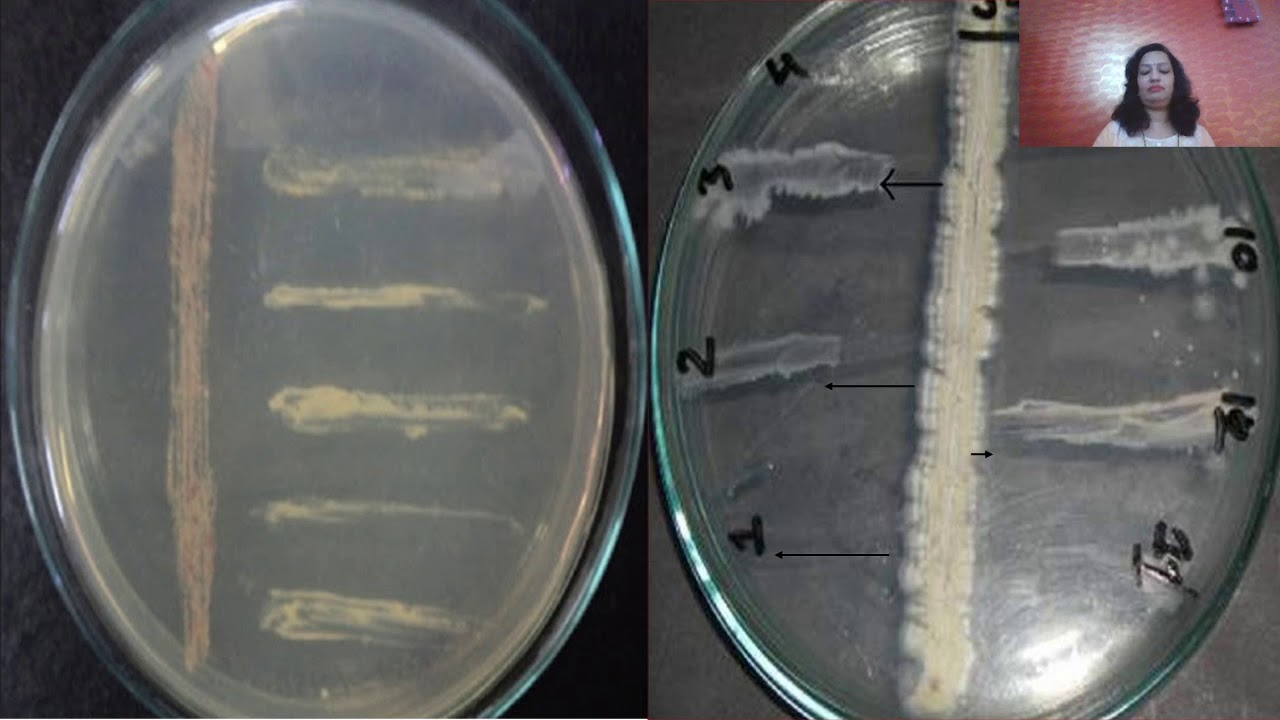 Isolation, Characterization and Confirmation of Antibiotic Production ...